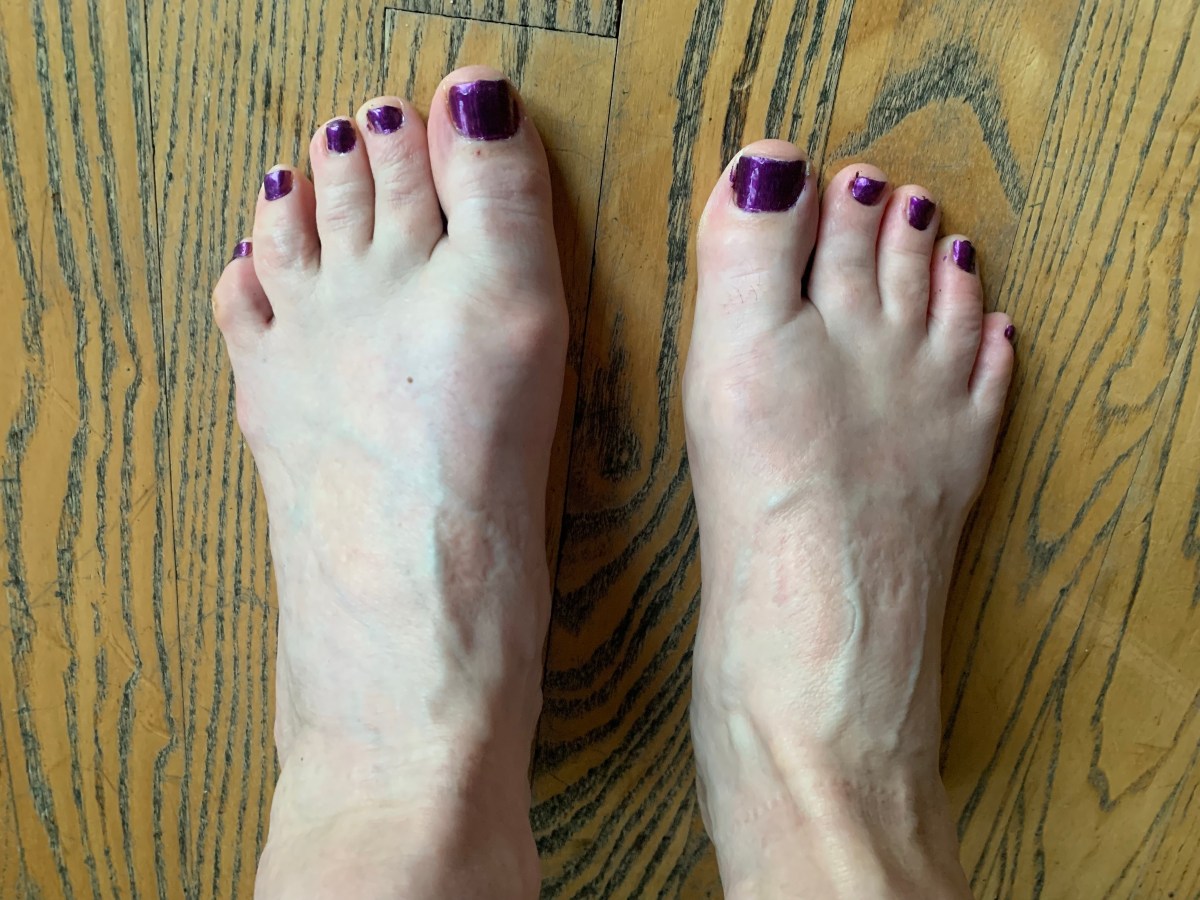 Feet – Surprised By Joy